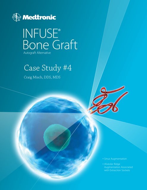INFUSEÂ® Bone Graft - BioHorizons