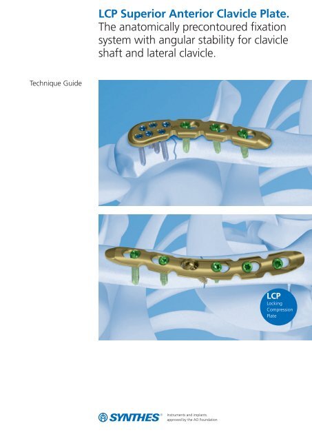 LCP Superior Anterior Clavicle Plate. The anatomically ...