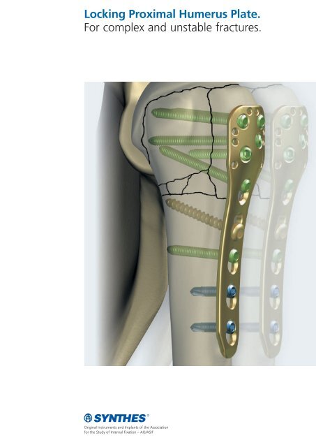 Locking Proximal Humerus Plate. For complex and ... - Osteosyntese