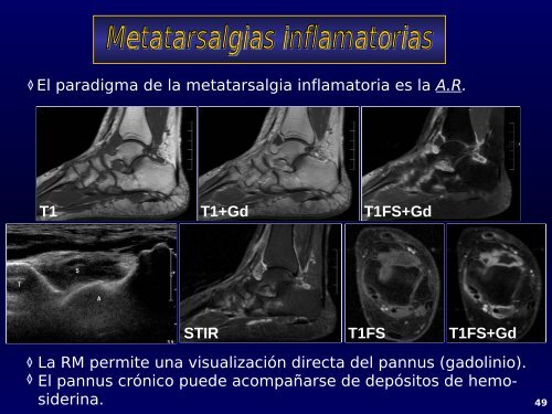 Patología de tobillo y pie