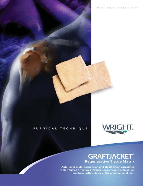 graftjacket - Wright Medical Technology, Inc.
