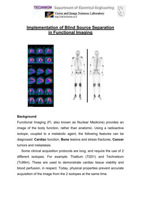 Implementation of Blind Source Separation in Functional Imaging