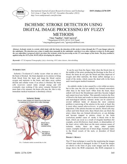 ischemic stroke detection using digital image processing by fuzzy ...