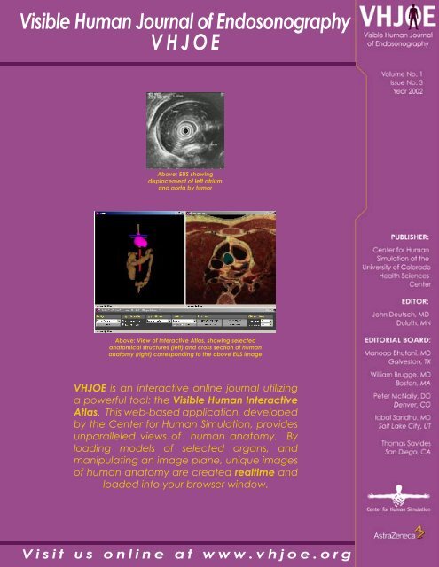 VHJOE Issue 3 - Visible Human Journal of Endoscopy