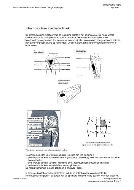 Intramusculaire injectietechniek - Vilans