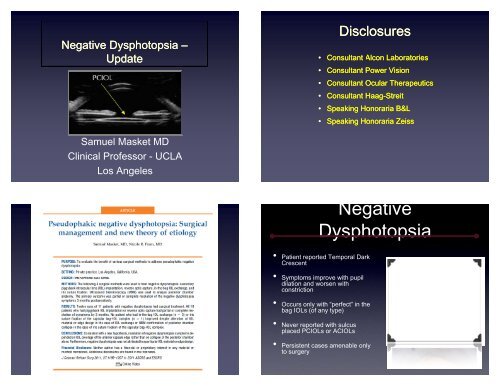 Negative Dysphotopsia