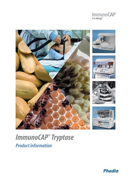 What is Tryptase - Phadia