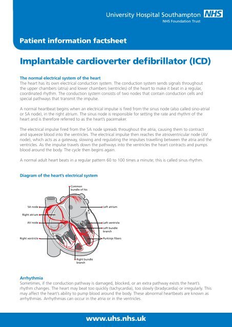 Implantable cardioverter defibrillator (ICD)