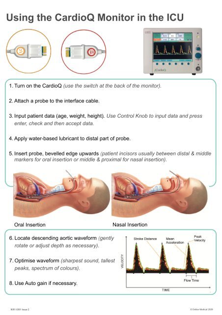 Using the CardioQ Monitor in the ICU - Deltex Medical