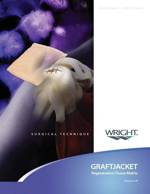 017-103 GJ RotatorCuff 4.qxp - Wright Medical Technology, Inc.