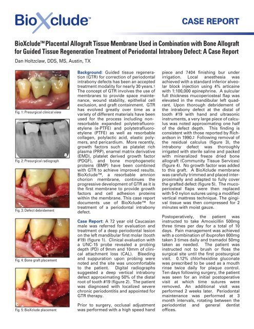 BioXclude study 1 - Citagenix