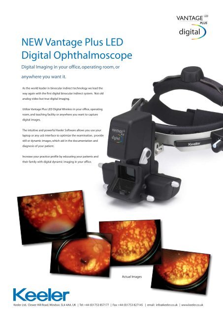 NEW Vantage Plus LED Digital Ophthalmoscope - Keeler Instruments