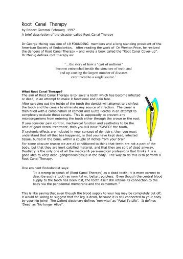 Root Canal Therapy - Consent Form - Ranes Exclusively Yours Dental
