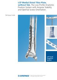 LCP Low Bend Medial Distal Tibia Plates 3.5 mm - Synthes