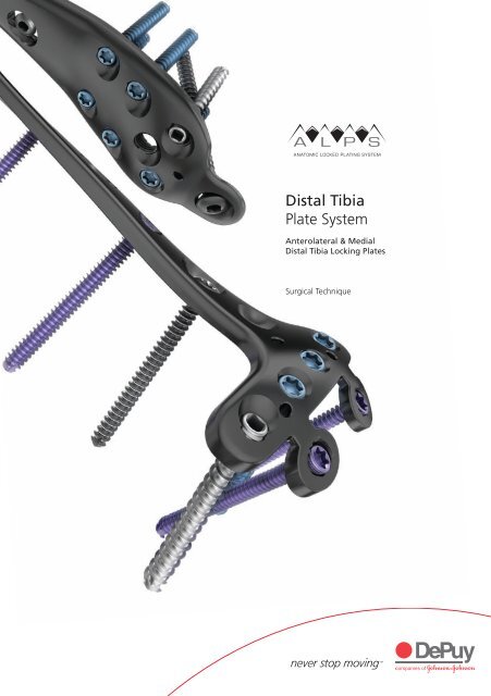Distal Tibia Plate System - Biomet