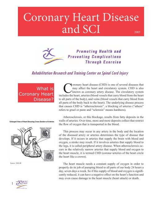 Coronary Heart Disease Fact sheet - Rehabilitation Research and ...