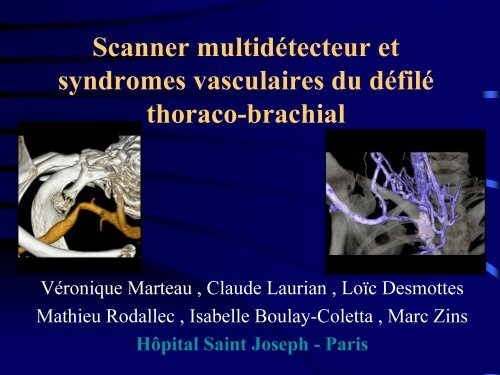 Scanner multidÃ©tecteur et syndromes vasculaires du dÃ©filÃ© thoraco ...