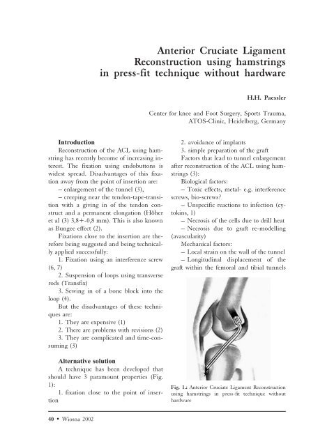 Anterior Cruciate Ligament Reconstruction using hamstrings in ...