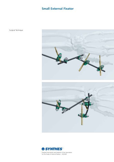 Small External Fixator Synthes