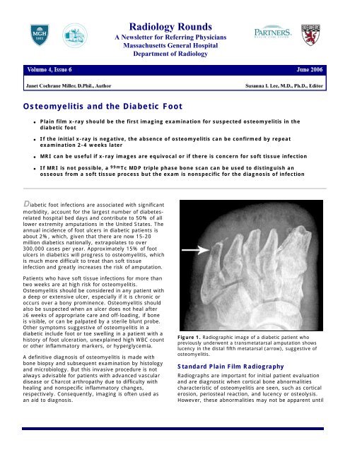 Osteomyelitis and the Diabetic Foot - Radiology Rounds