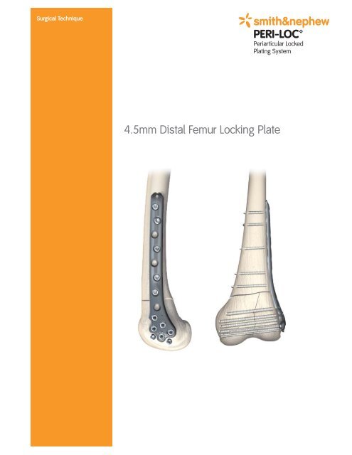 71180950 PERI-LOC LOCKING DISTAL FEMUR PLATE.pdf