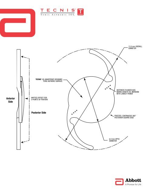 Anterior Side Posterior Side - TECNIS® Aspheric IOLs