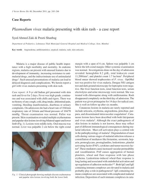 Plasmodium vivax malaria presenting with skin rash - a case report