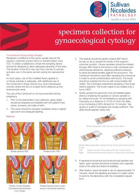 Specimen collection for gynaecological cytology - Sullivan ...
