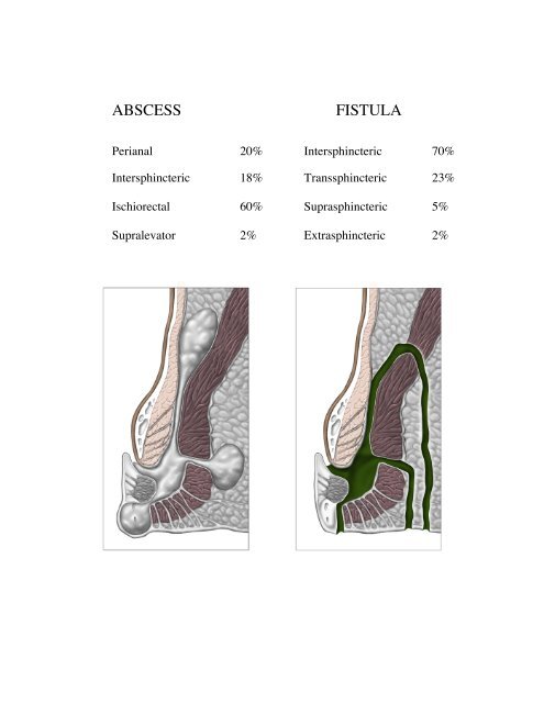 WHAT IS AN ANORECTAL ABSC