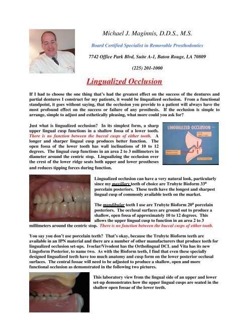 Lingualized Occlusion - ProSites
