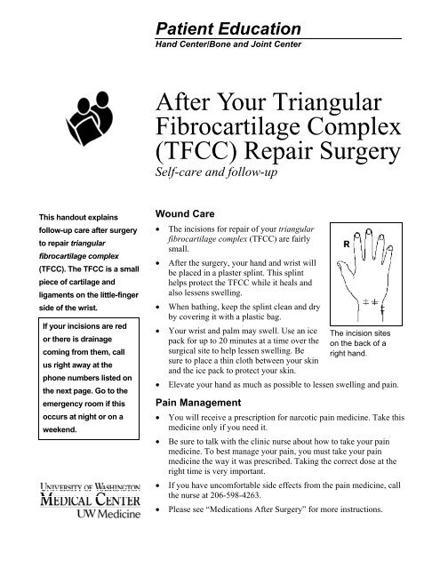 (TFCC) Repair - UWMC Health On-Line - University of Washington