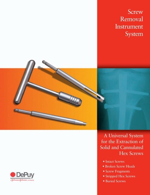 Screw Removal Instrument System Brochure - Biomet