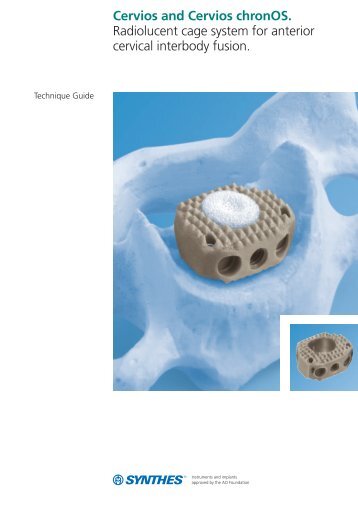 Plivios and Plivios chronOS. Radiolucent cage system for ... - Synthes