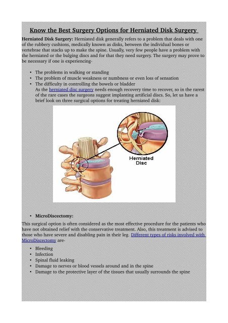 Know the Best Surgery Options for Herniated Disk Surgery