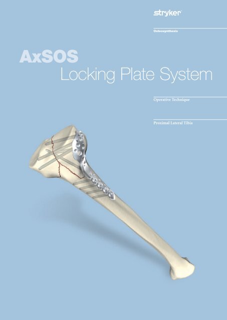 AxSOS Locking Plate System - Stryker