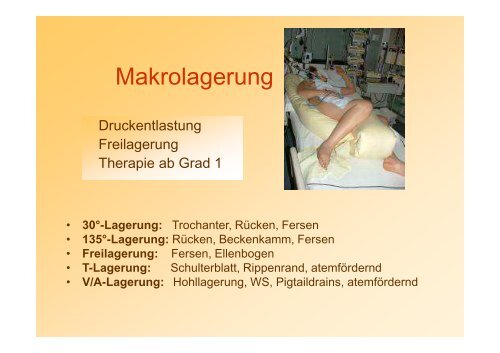 Makrolagerung Druckentlas