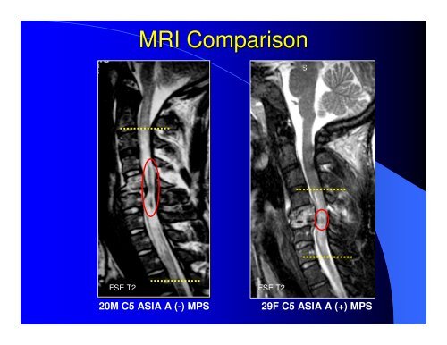 MRI Comp