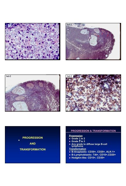 cl-2 ↑ ↑ ↑ bcl-2 bc