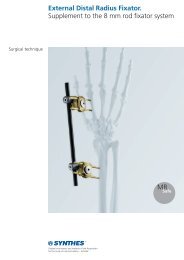 LCP Dia-Meta Volar Distal Radius Plates - Synthes