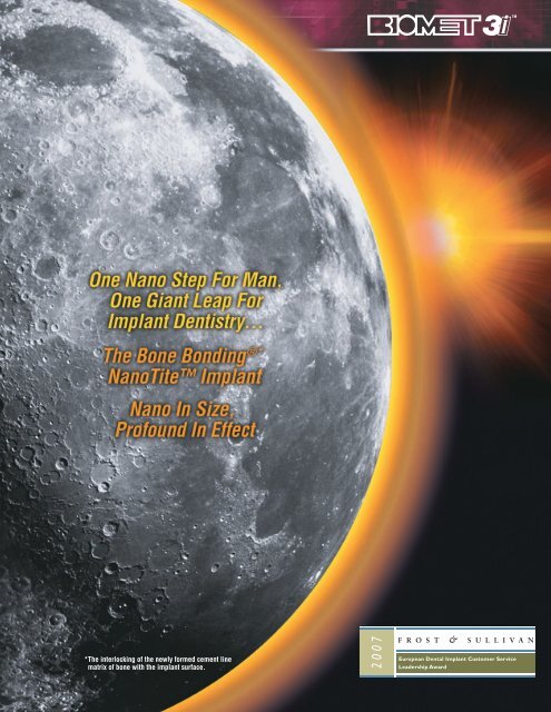 NanoTite â ¢ Implant Brochure - Biomet 3i