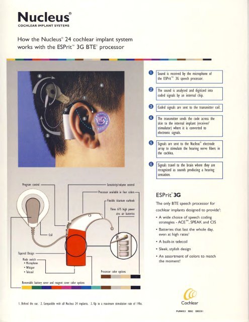 Nucleus' COCHLEAR IMPLANT