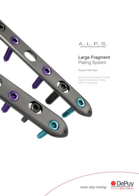 Large Fragment Plating System - Biomet