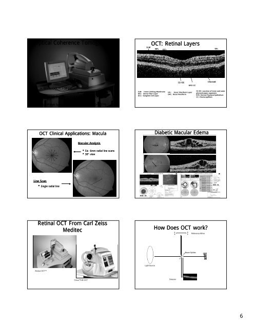 Optical Coherence Tomography OCT: Retinal Layers Retinal OCT ...