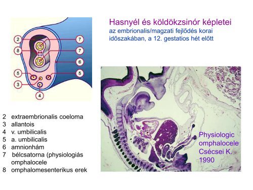 arteria umbilicalis singularis - Dr. Csécsei Károly