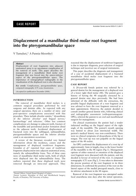 Displacement of a mandibular third molar root fragment - Exodonti.info