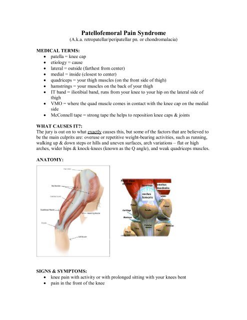 Patellofemoral Pain Syndrome - IRG