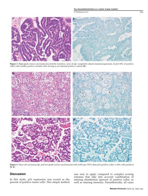 P53 immunohistochemistry
