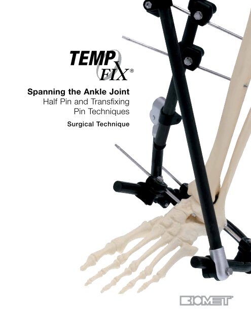 Spanning the Ankle Joint Half Pin and Transfixing Pin ... - Biomet