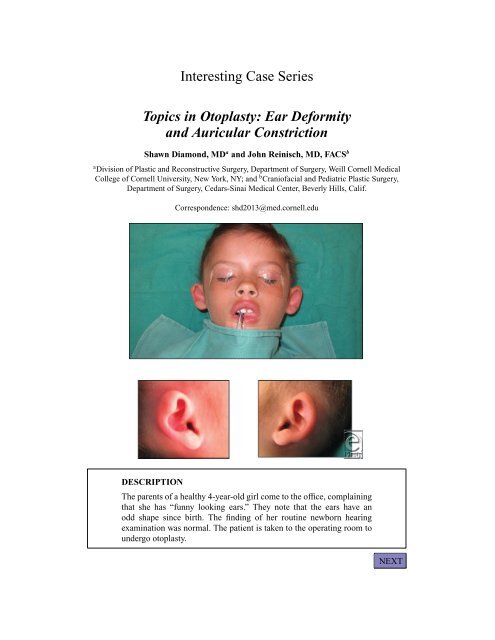 Ear Deformity and Auricular Constriction - ePlasty