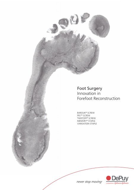Foot Surgery Innovation in Forefoot Reconstruction - Biomet